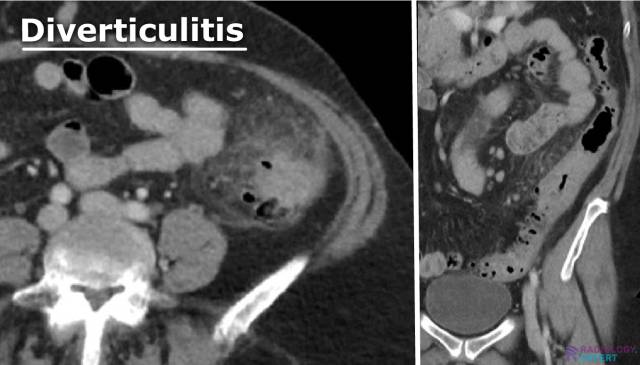 CT abdomen general